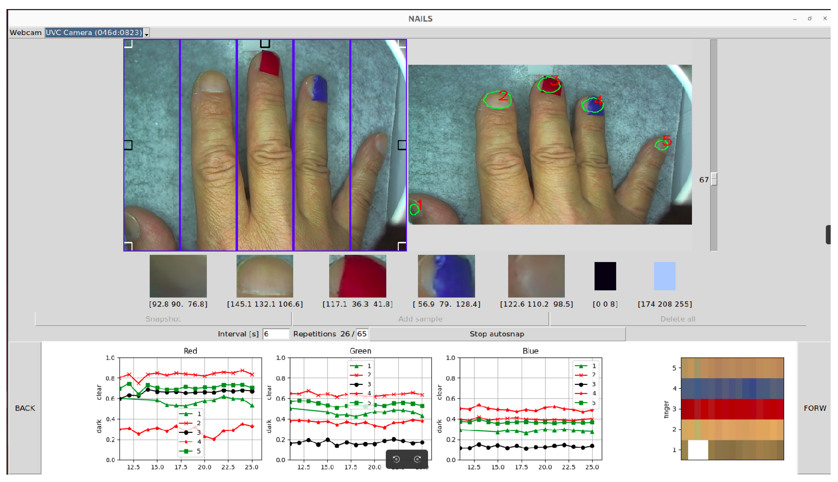 NAILS: Normalized Artificial Intelligence Labeling Sensor for Self-Care ...