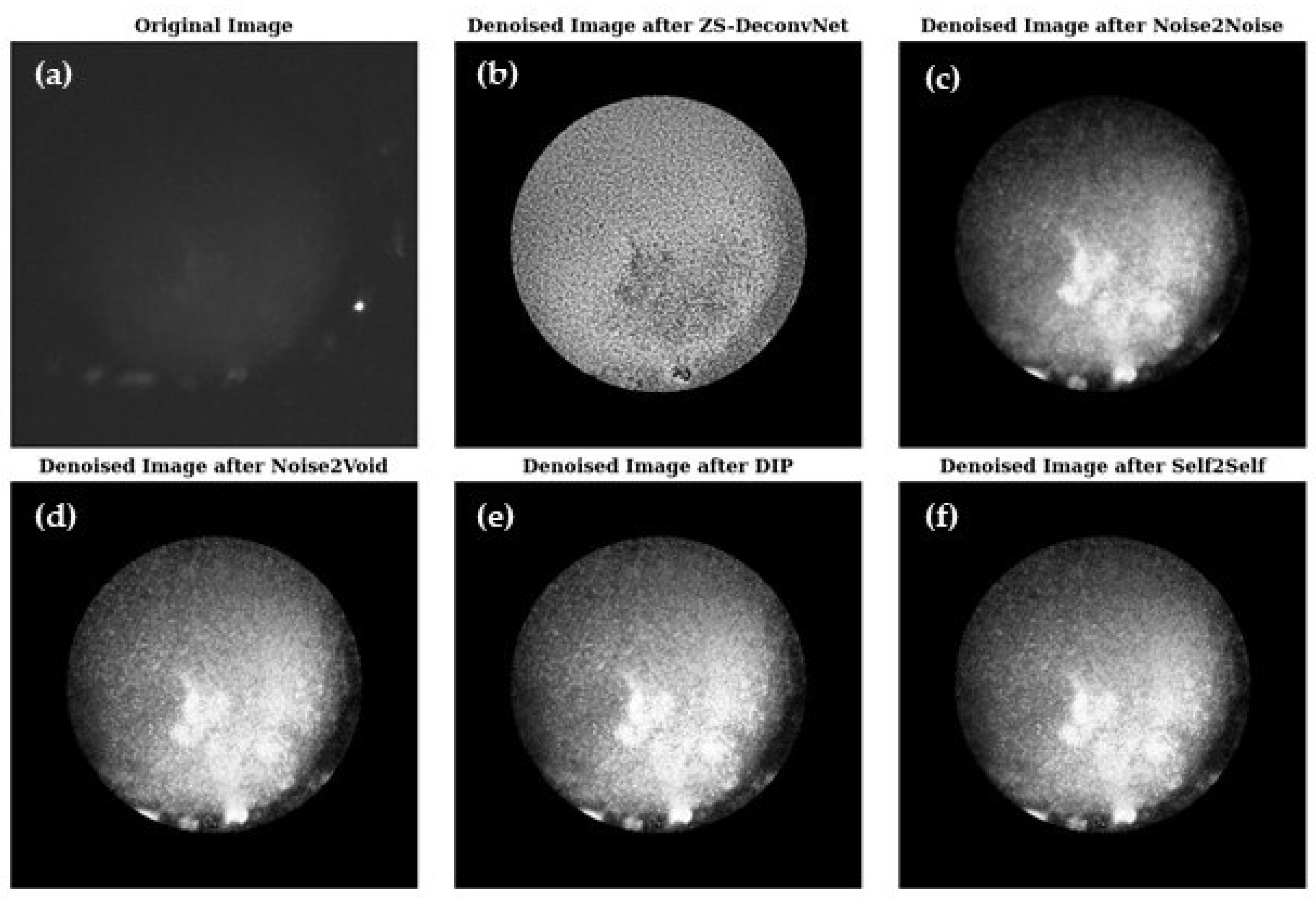 Self-Supervised and Zero-Shot Learning in Multi-Modal Raman Light Sheet Microscopy