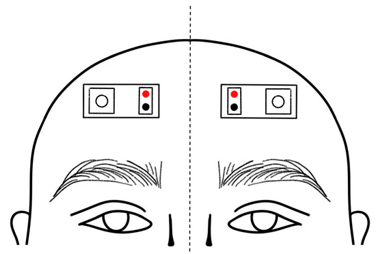A NIRS-Based Technique for Monitoring Brain Tissue Oxygenation in ...