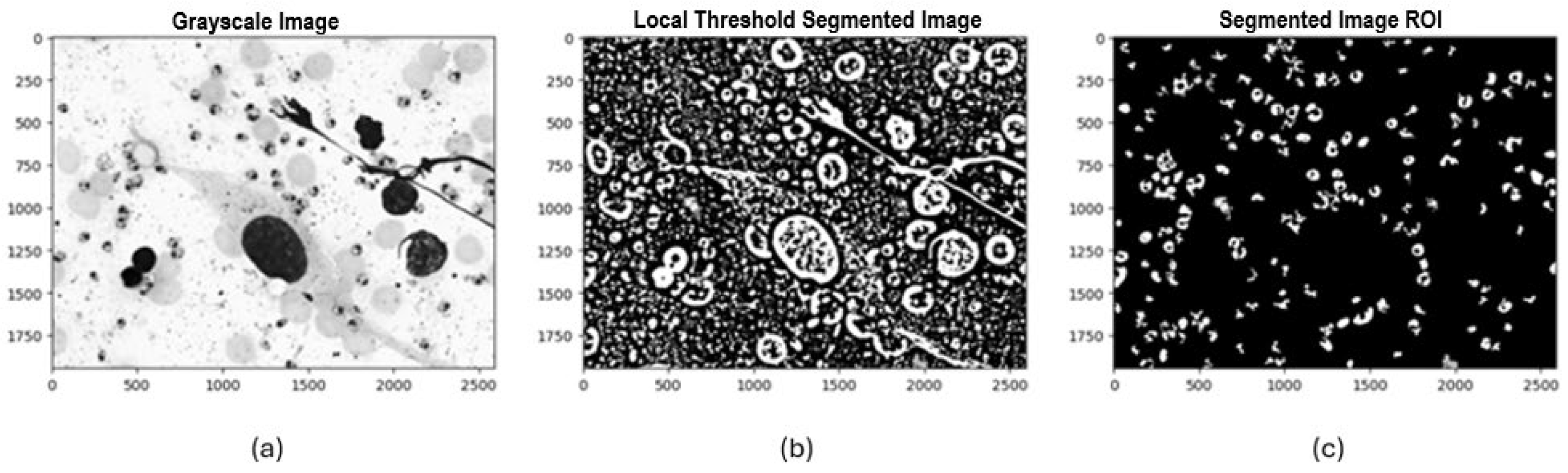 Enhanced Detection of Leishmania Parasites in Microscopic Images Using ...