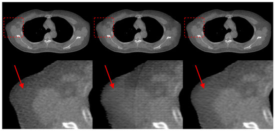 Prior-FOVNet: A Multimodal Deep Learning Framework for Megavoltage ...