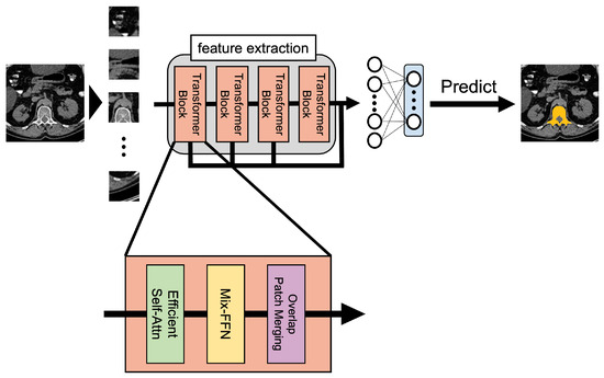 Data-Efficient Bone Segmentation Using Feature Pyramid- Based SegFormer