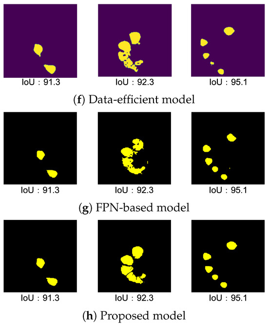 Data-Efficient Bone Segmentation Using Feature Pyramid- Based SegFormer