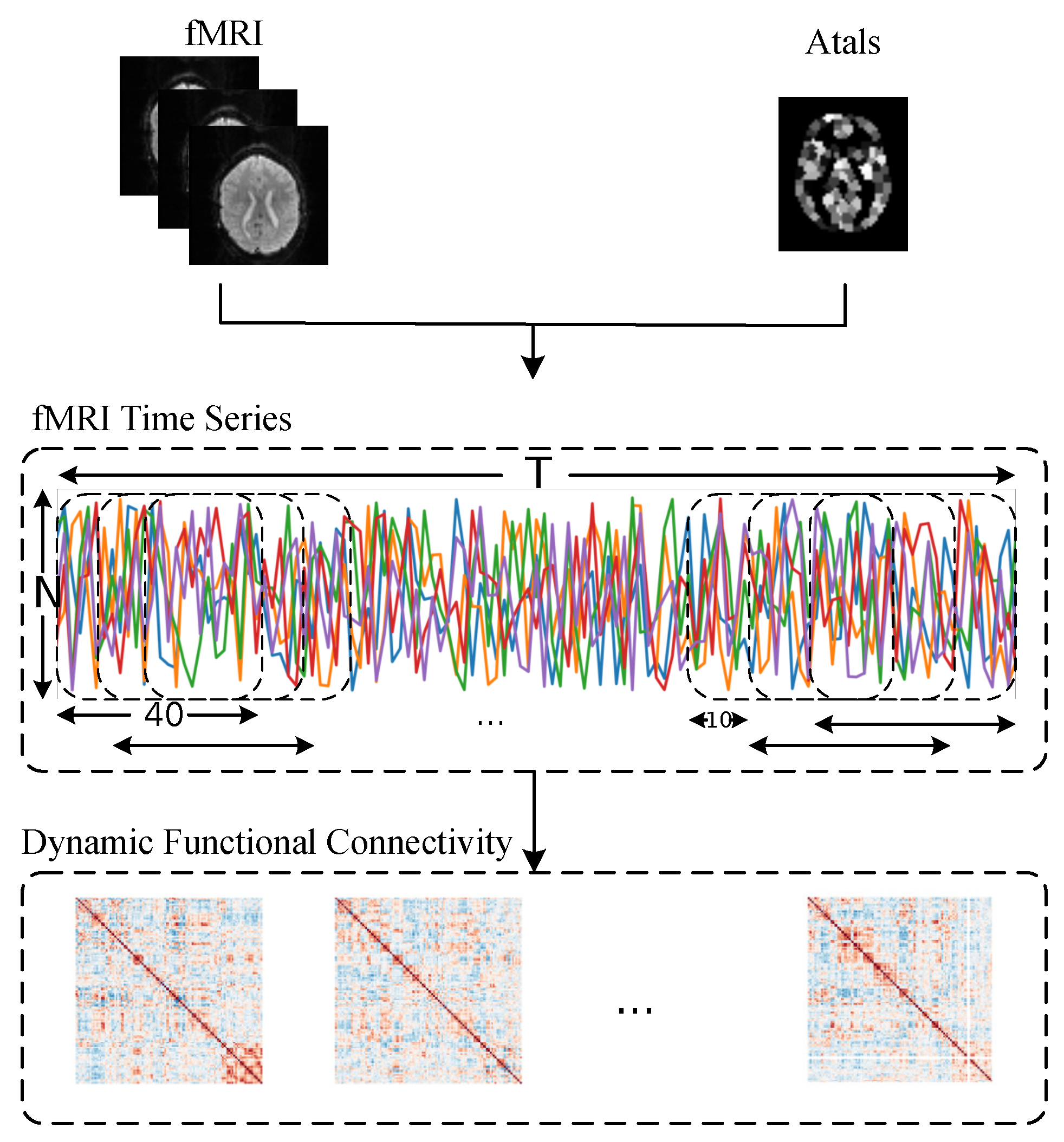 Diagnosis of Autism Spectrum Disorder (ASD) by Dynamic Functional Connectivity Using GNN-LSTM