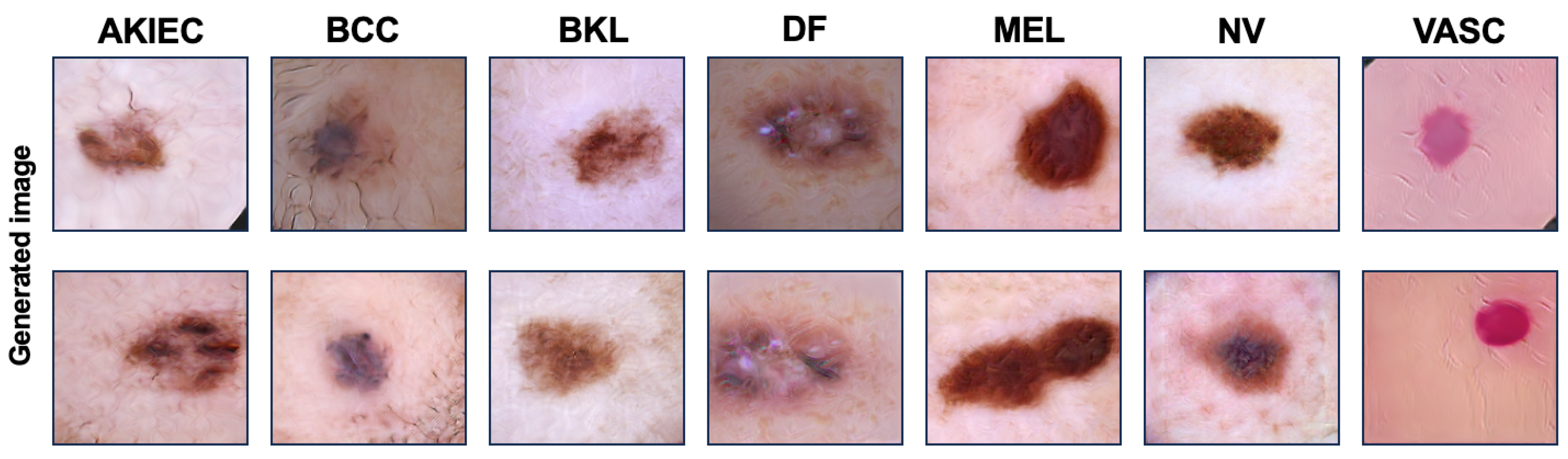 An Enhanced Approach Using AGS Network for Skin Cancer Classification