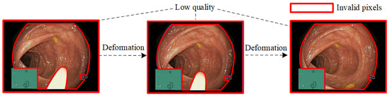 Neural Radiance Fields for High-Fidelity Soft Tissue Reconstruction in ...
