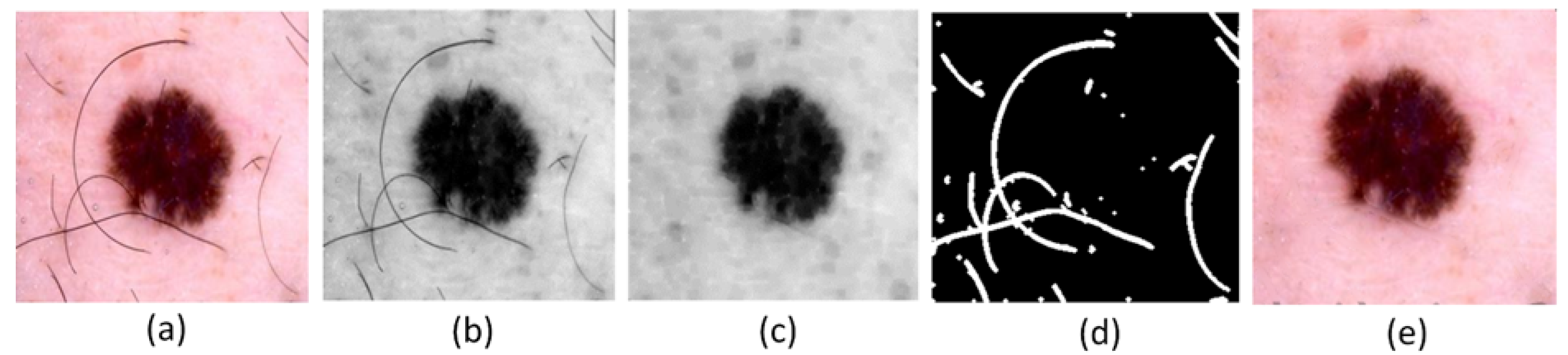 Advanced Deep Learning Models for Melanoma Diagnosis in Computer-Aided ...