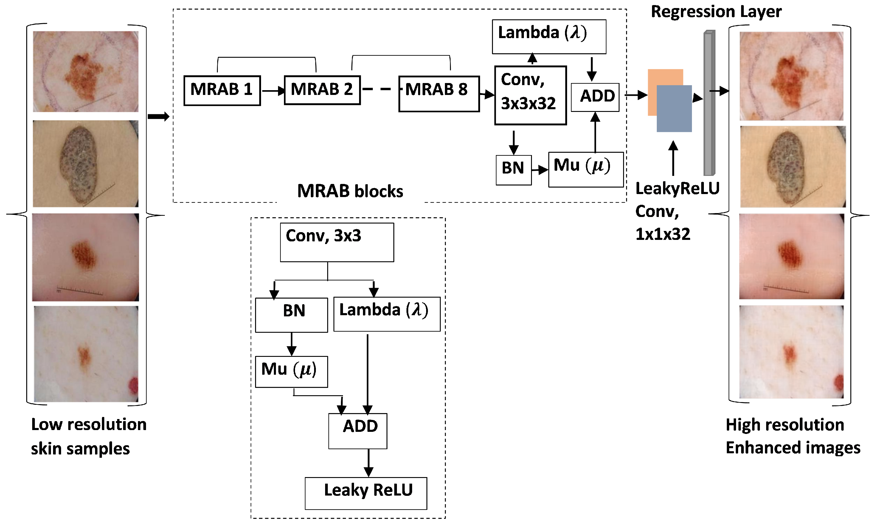 Advanced Deep Learning Models for Melanoma Diagnosis in Computer-Aided ...