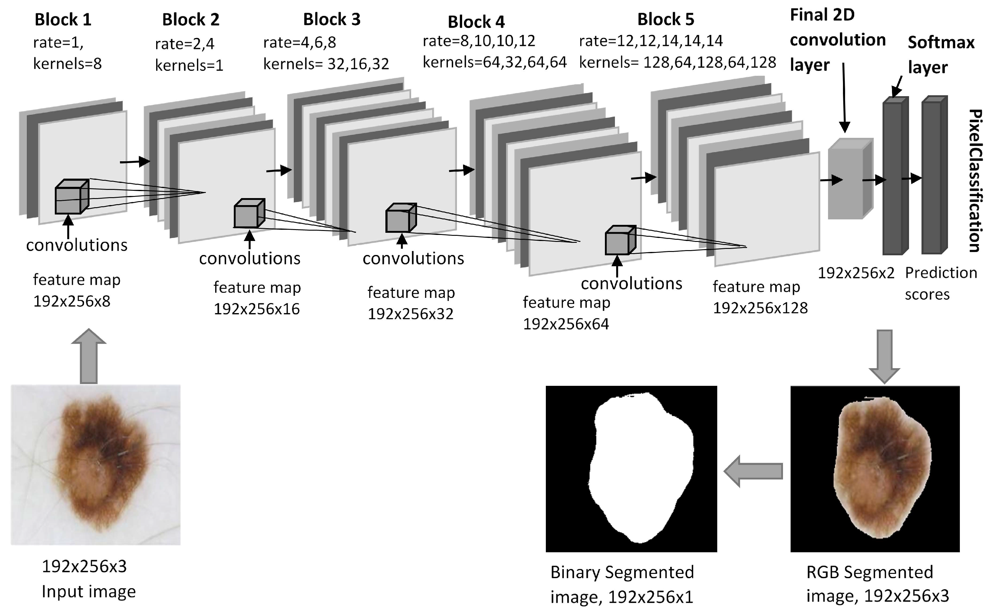 Advanced Deep Learning Models for Melanoma Diagnosis in Computer-Aided ...