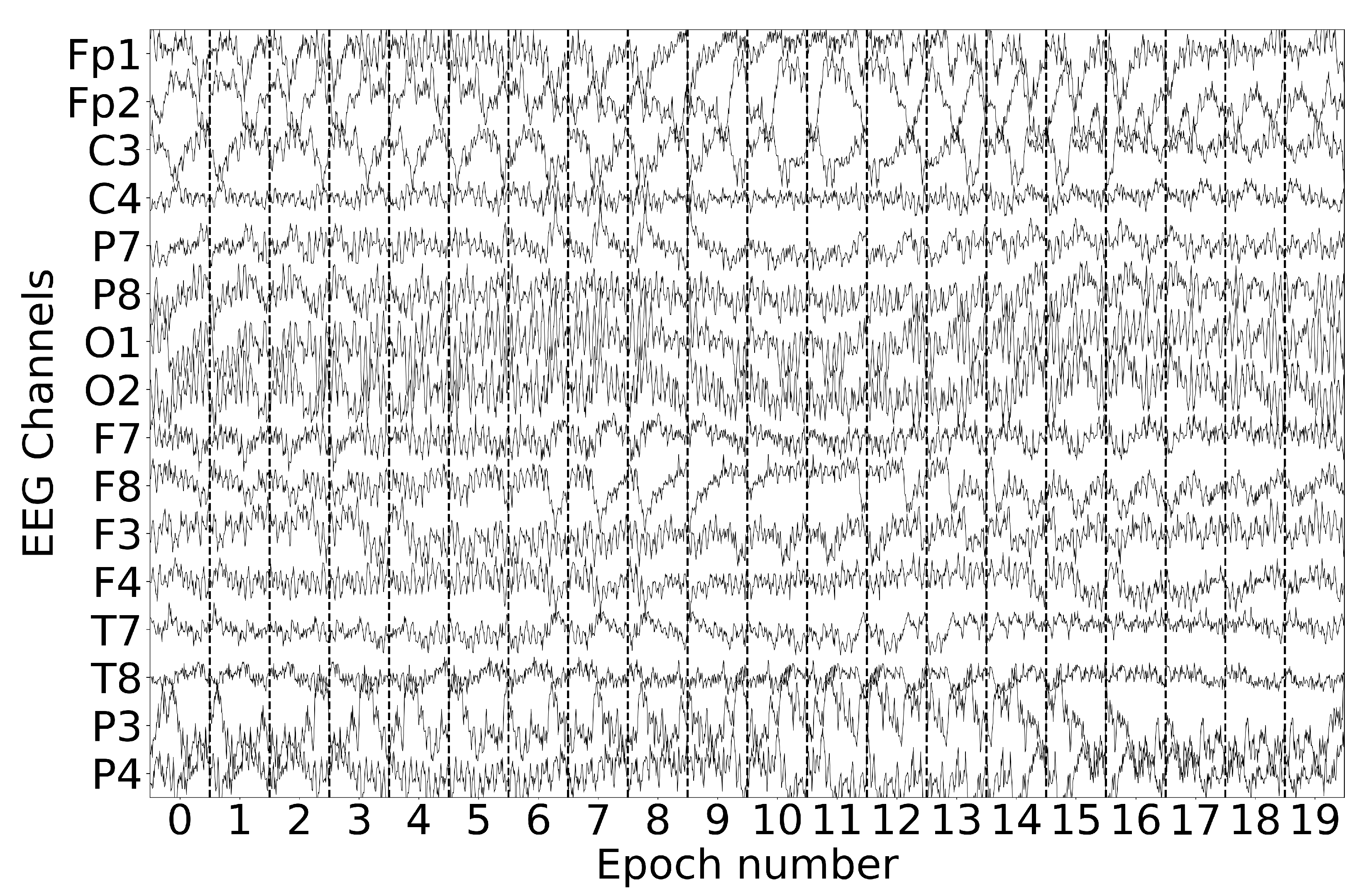 NeuroFlex: Feasibility of EEG-Based Motor Imagery Control of a Soft Glove for Hand Rehabilitation