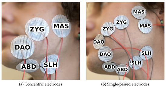 Electrode Setup for Electromyography-Based Silent Speech Interfaces: A ...