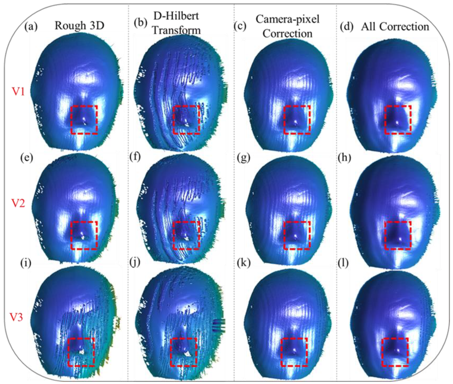 Dynamic 3D Measurement Based on Camera-Pixel Mismatch Correction and ...