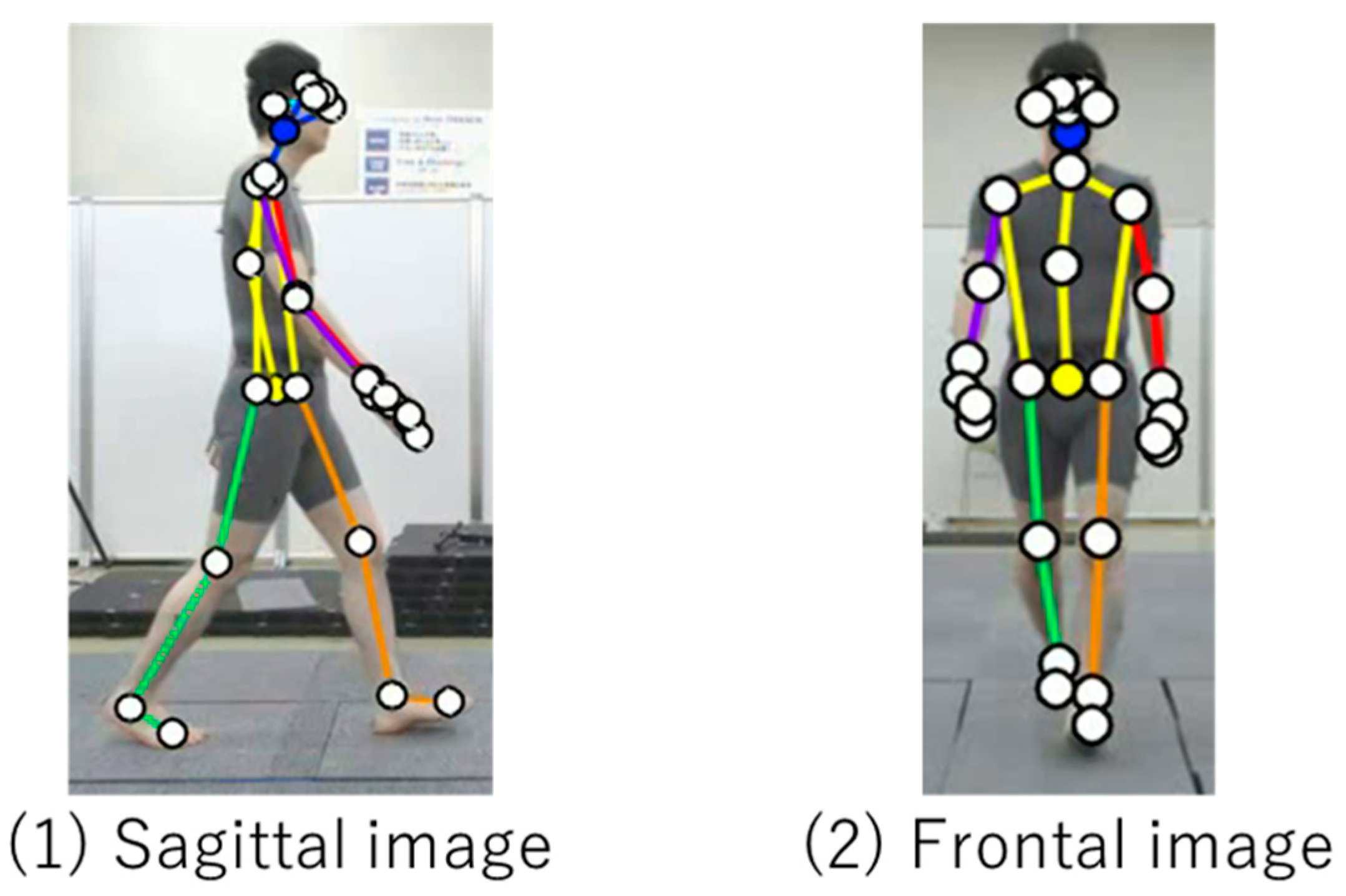 Reliability and Validity Examination of a New Gait Motion Analysis System