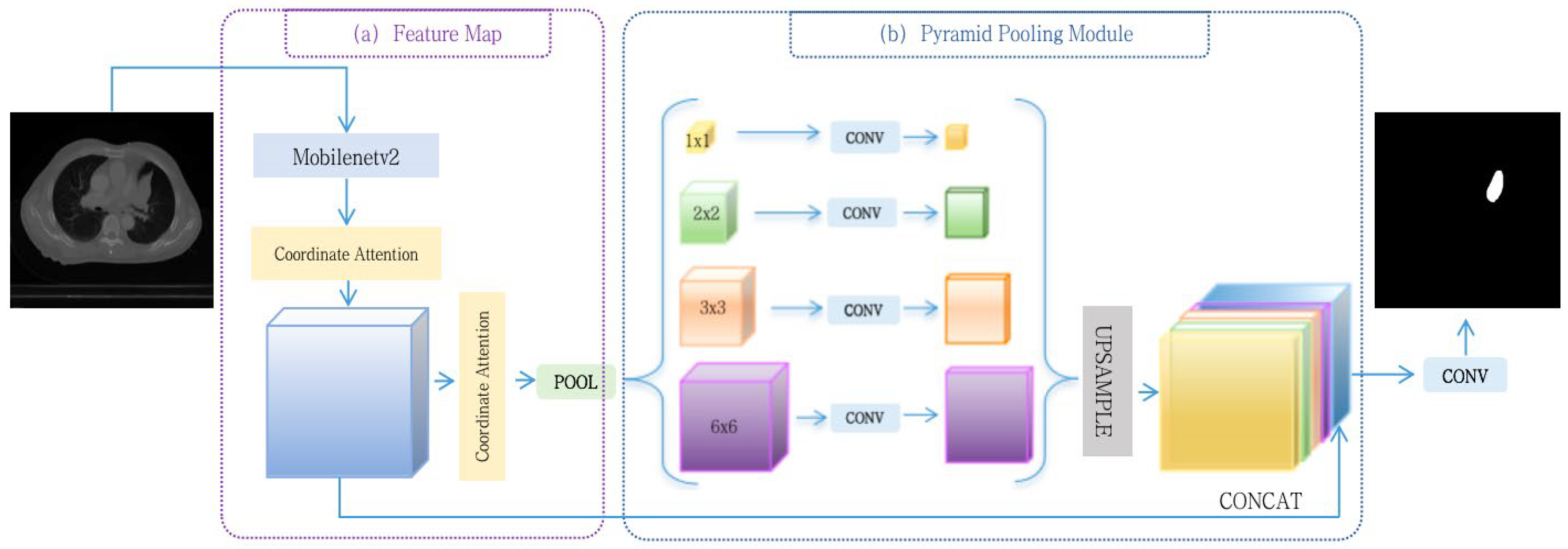 CAML-PSPNet: A Medical Image Segmentation Network Based on Coordinate Attention and a Mixed Loss ...