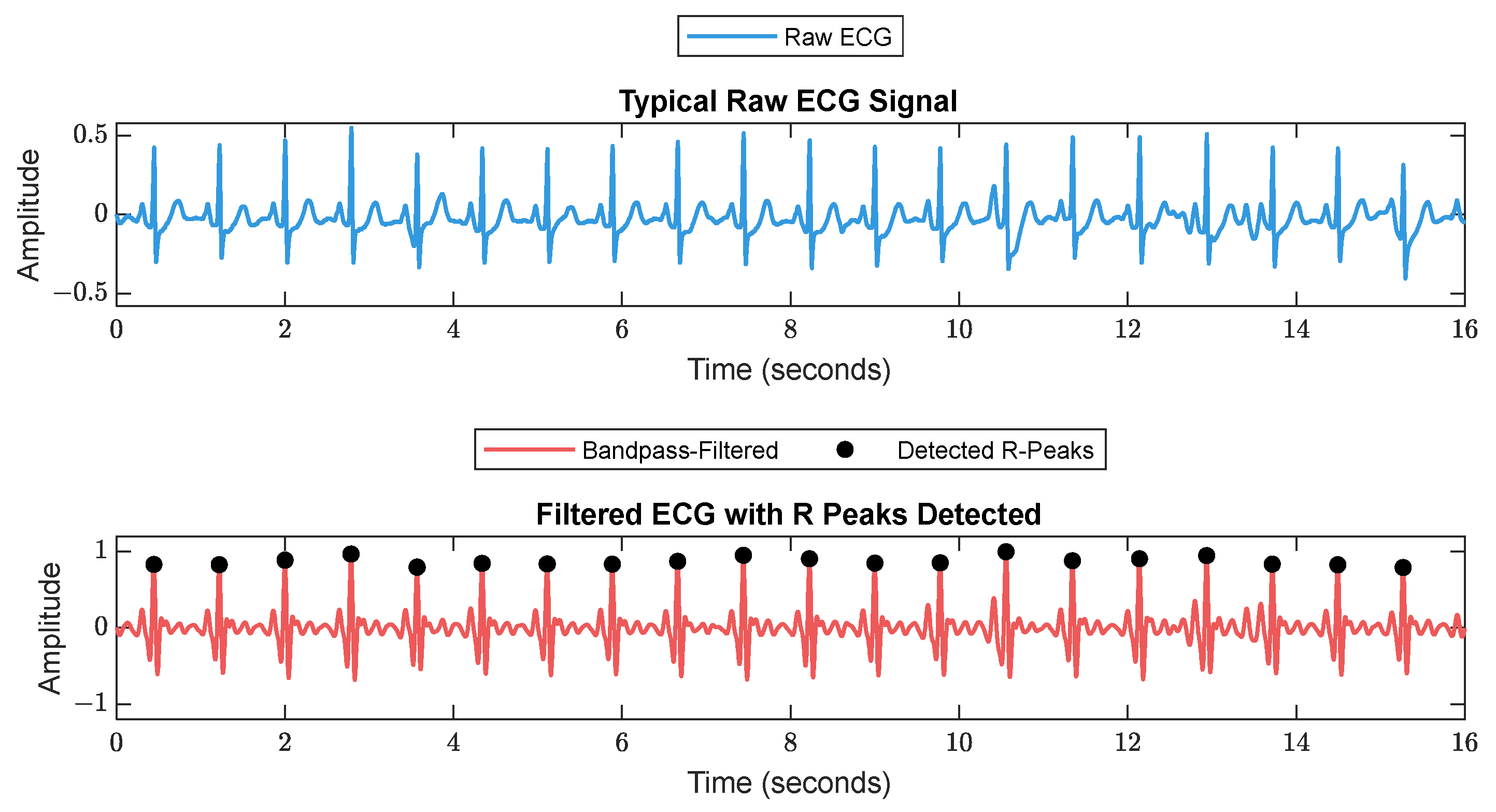 A Multimodal Deep Learning Approach to Intraoperative Nociception Monitoring: Integrating ...