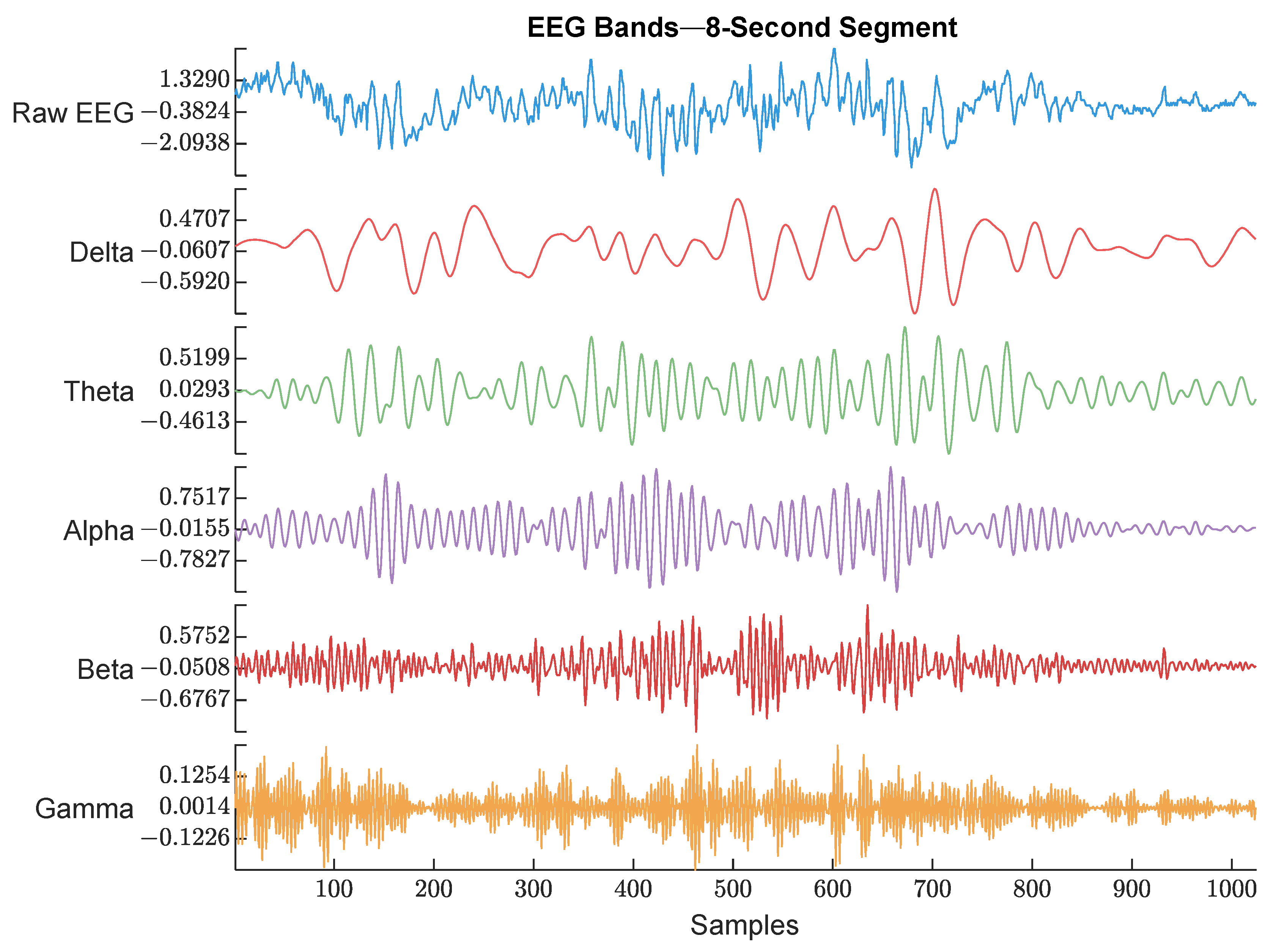 A Multimodal Deep Learning Approach to Intraoperative Nociception Monitoring: Integrating ...