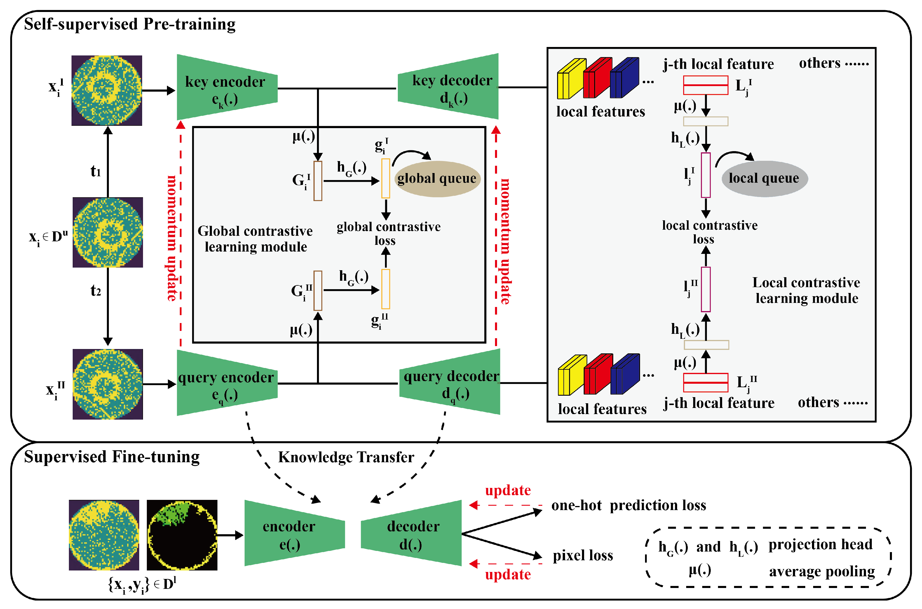 Contrastive Learning with Global and Local Representation for Mixed-Type Wafer Defect Recognition