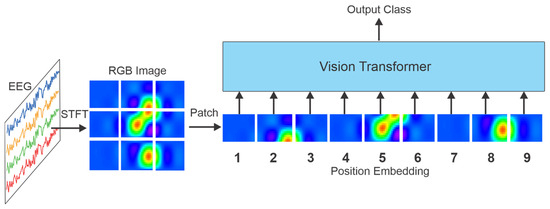 Transformers in EEG Analysis: A Review of Architectures and ...