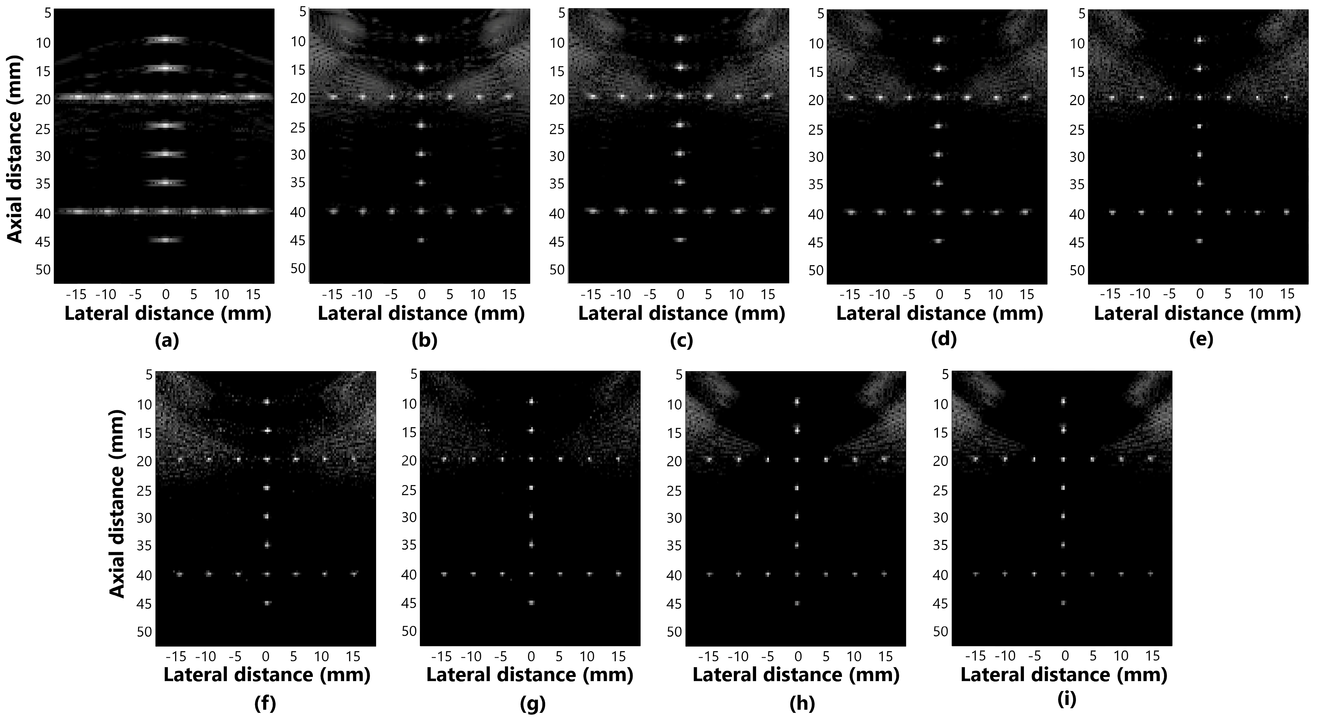 Improving Ultrasound B-Mode Image Quality with Coherent Plane-Wave ...