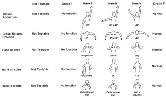 Automated Assessment of Upper Extremity Function with the Modified ...