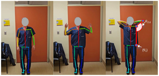 Automated Assessment of Upper Extremity Function with the Modified ...