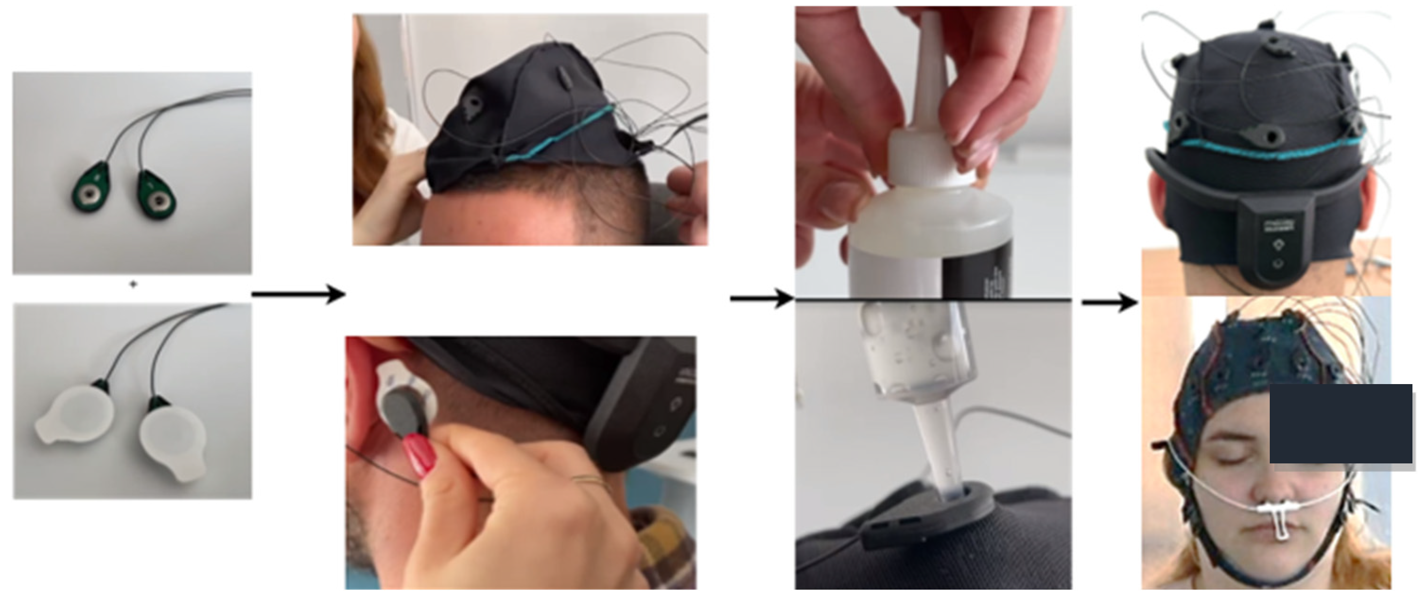 Optimizing Depression Classification Using Combined Datasets and Hyperparameter Tuning with Optuna