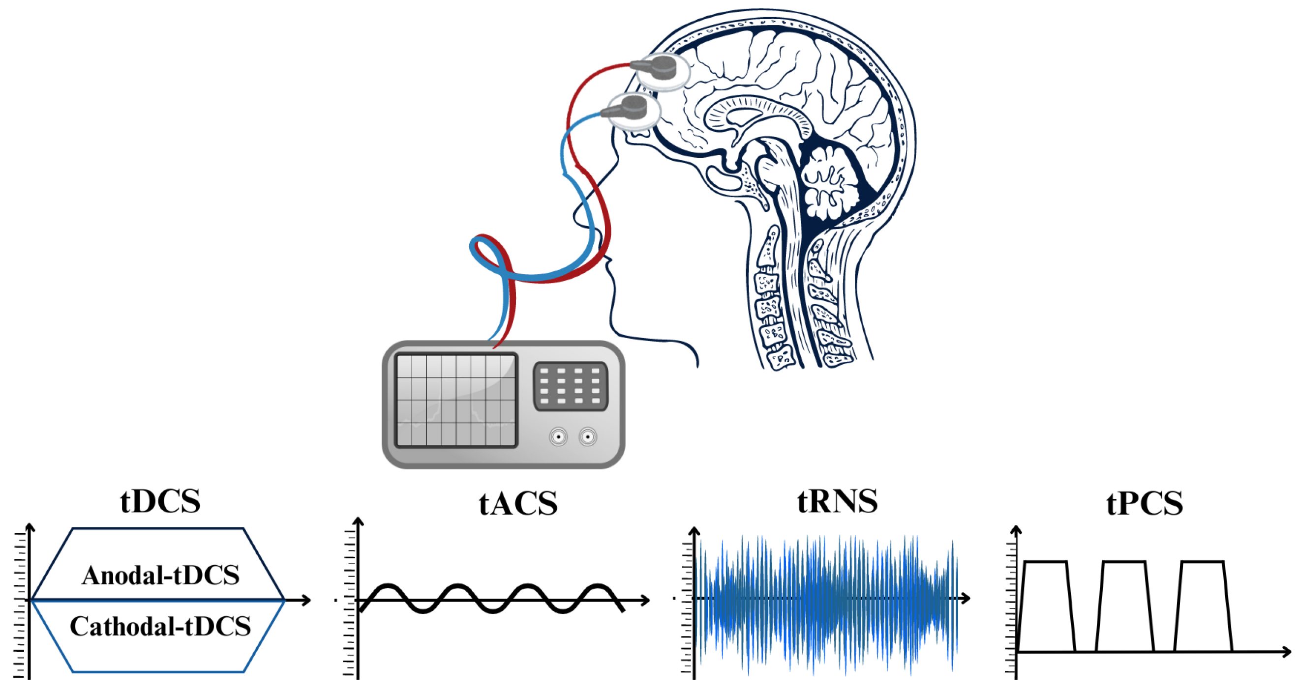 Impact of Electrical Stimulation on Mental Stress, Depression, and ...