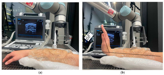 Method of Forearm Muscles 3D Modeling Using Robotic Ultrasound Scanning