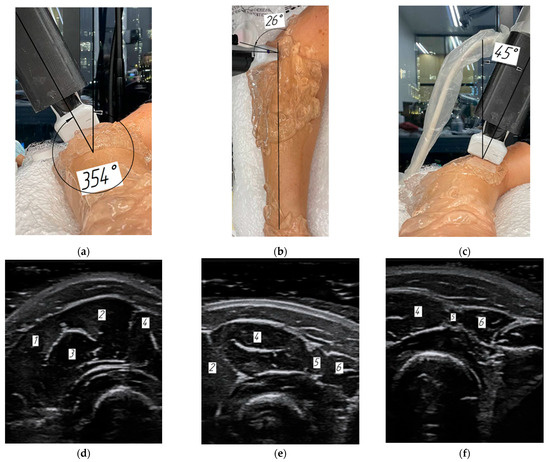 Method of Forearm Muscles 3D Modeling Using Robotic Ultrasound Scanning