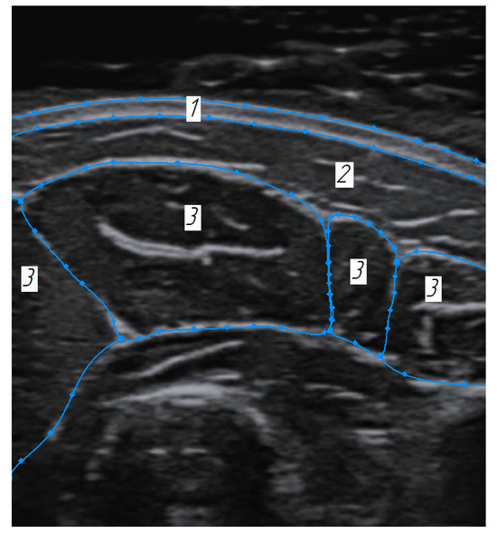 Method of Forearm Muscles 3D Modeling Using Robotic Ultrasound Scanning