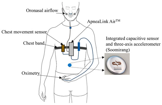 An Automated Algorithm for Obstructive Sleep Apnea Detection Using a Wireless Abdomen-Worn Sensor