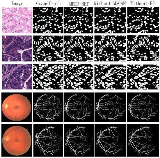 MDEU-Net: Medical Image Segmentation Network Based on Multi-Head Multi-Scale Cross-Axis