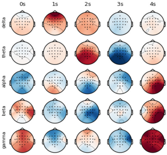 A Novel 3D Approach with a CNN and Swin Transformer for Decoding EEG ...