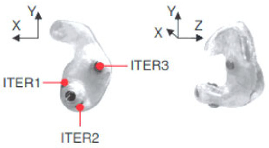 The Next Frontier in Brain Monitoring: A Comprehensive Look at In-Ear ...
