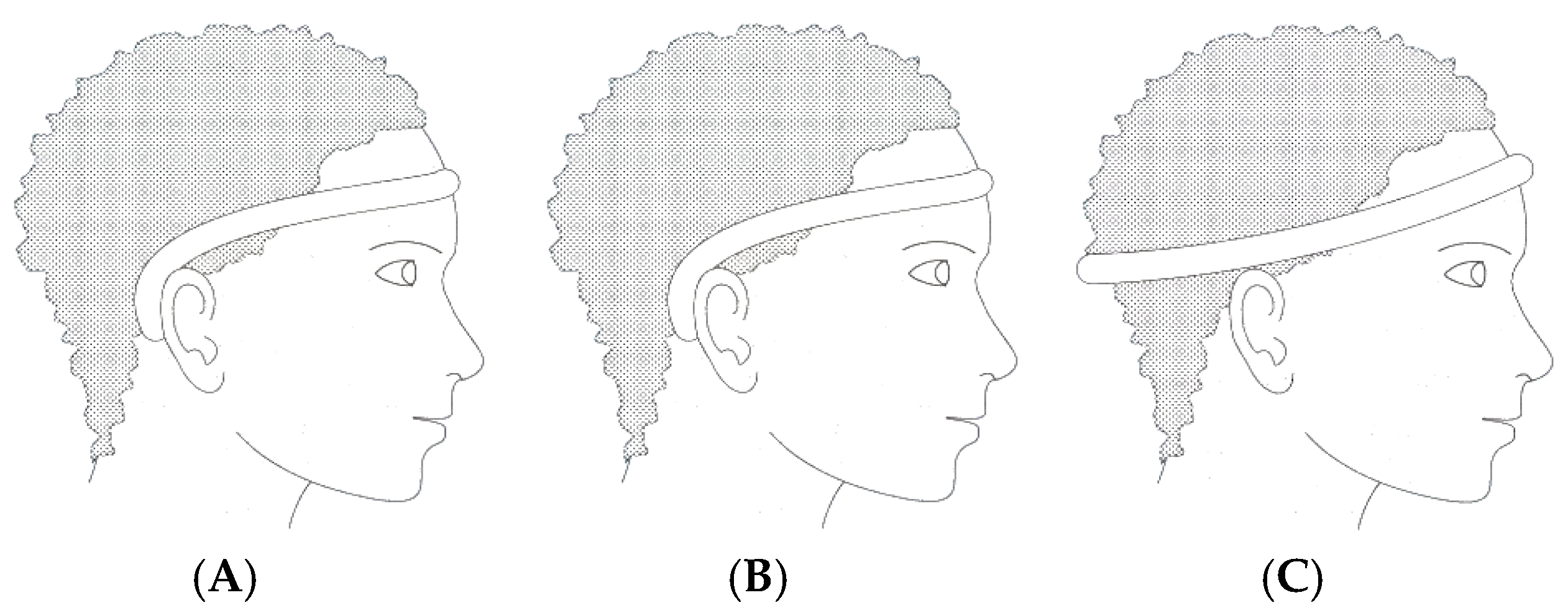 The Next Frontier in Brain Monitoring: A Comprehensive Look at In-Ear ...