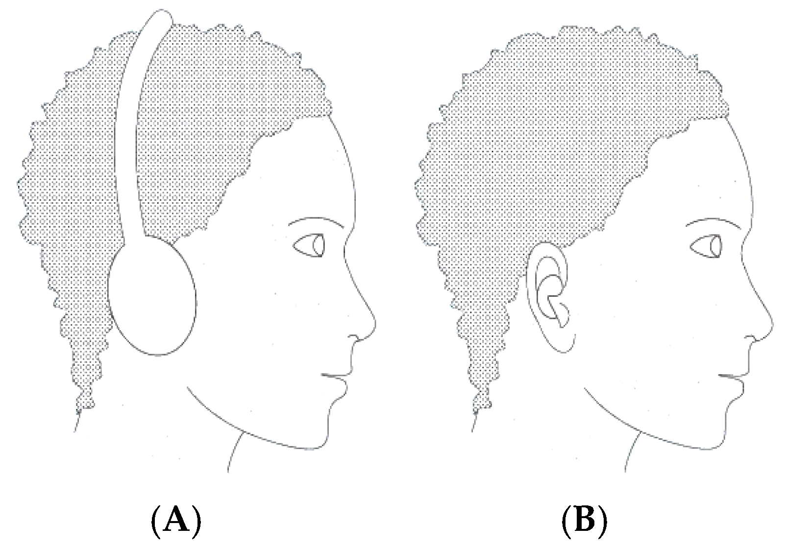 The Next Frontier in Brain Monitoring: A Comprehensive Look at In-Ear ...