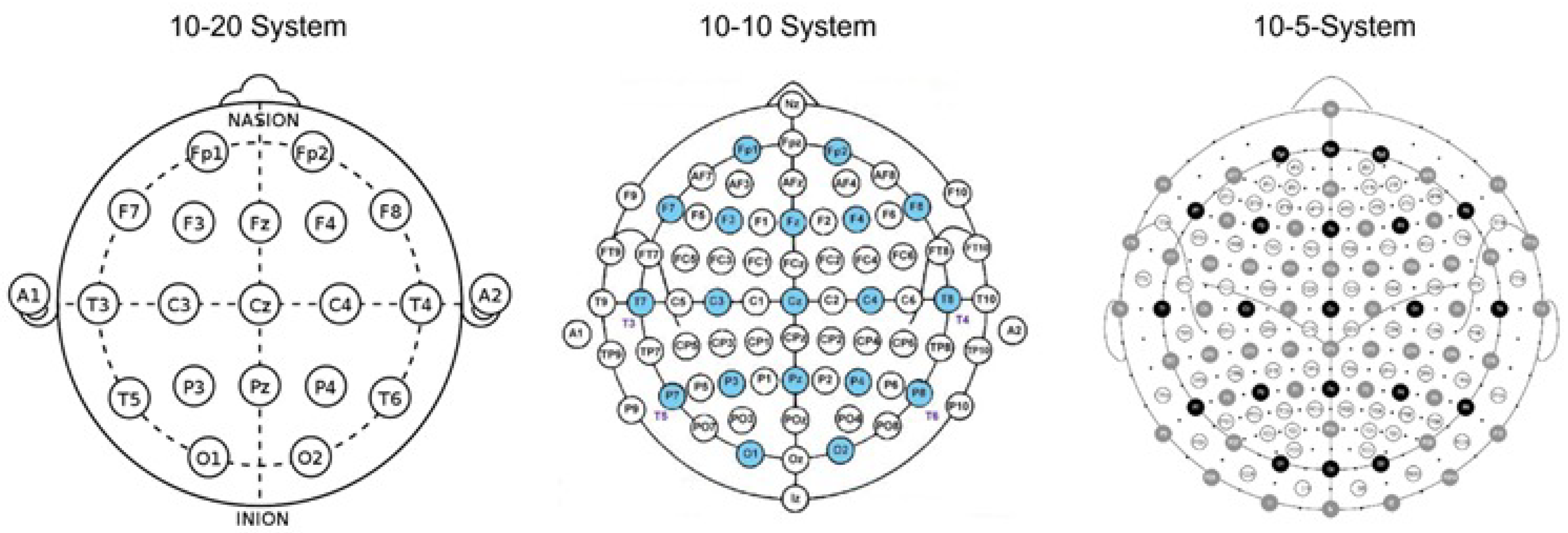 The Next Frontier in Brain Monitoring: A Comprehensive Look at In-Ear ...
