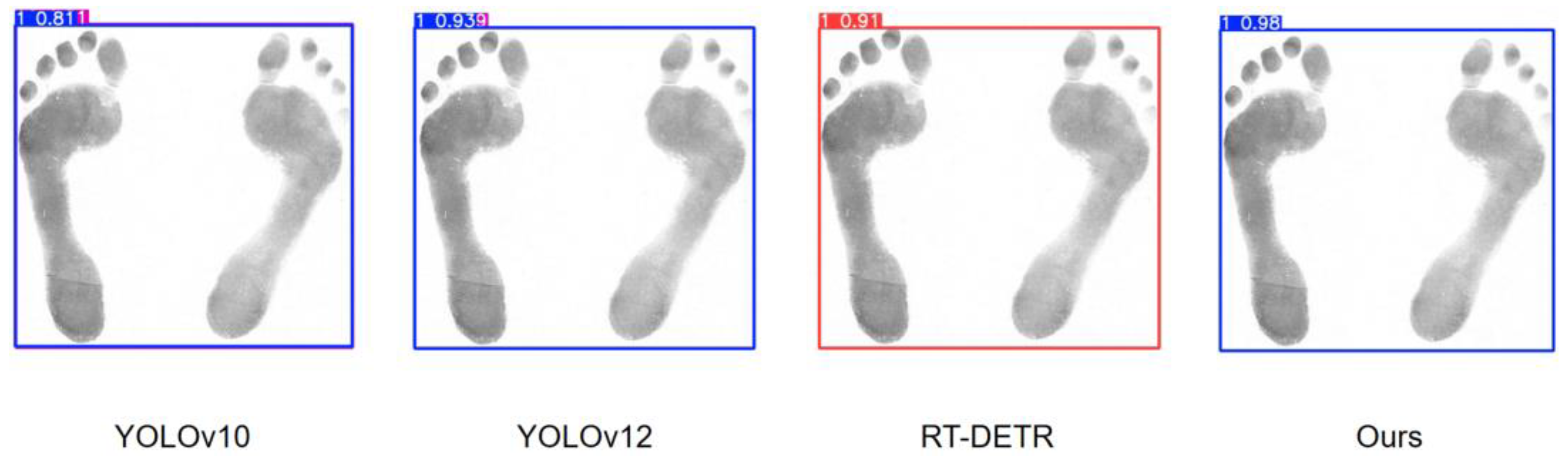 Barefoot Footprint Detection Algorithm Based on YOLOv8-StarNet