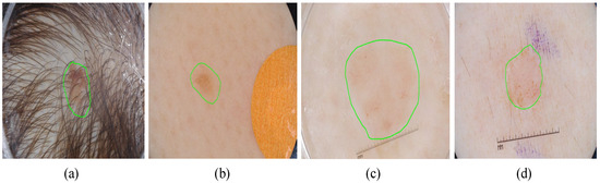 SGNet: A Structure-Guided Network with Dual-Domain Boundary Enhancement and Semantic Fusion for ...