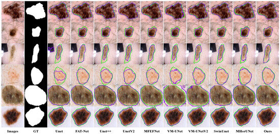 SGNet: A Structure-Guided Network with Dual-Domain Boundary Enhancement and Semantic Fusion for ...
