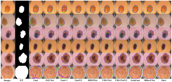 SGNet: A Structure-Guided Network with Dual-Domain Boundary Enhancement and Semantic Fusion for ...