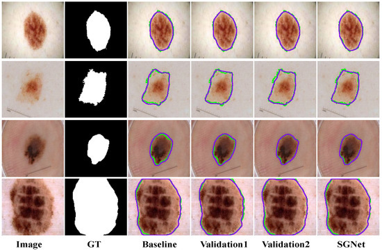 SGNet: A Structure-Guided Network with Dual-Domain Boundary Enhancement and Semantic Fusion for ...