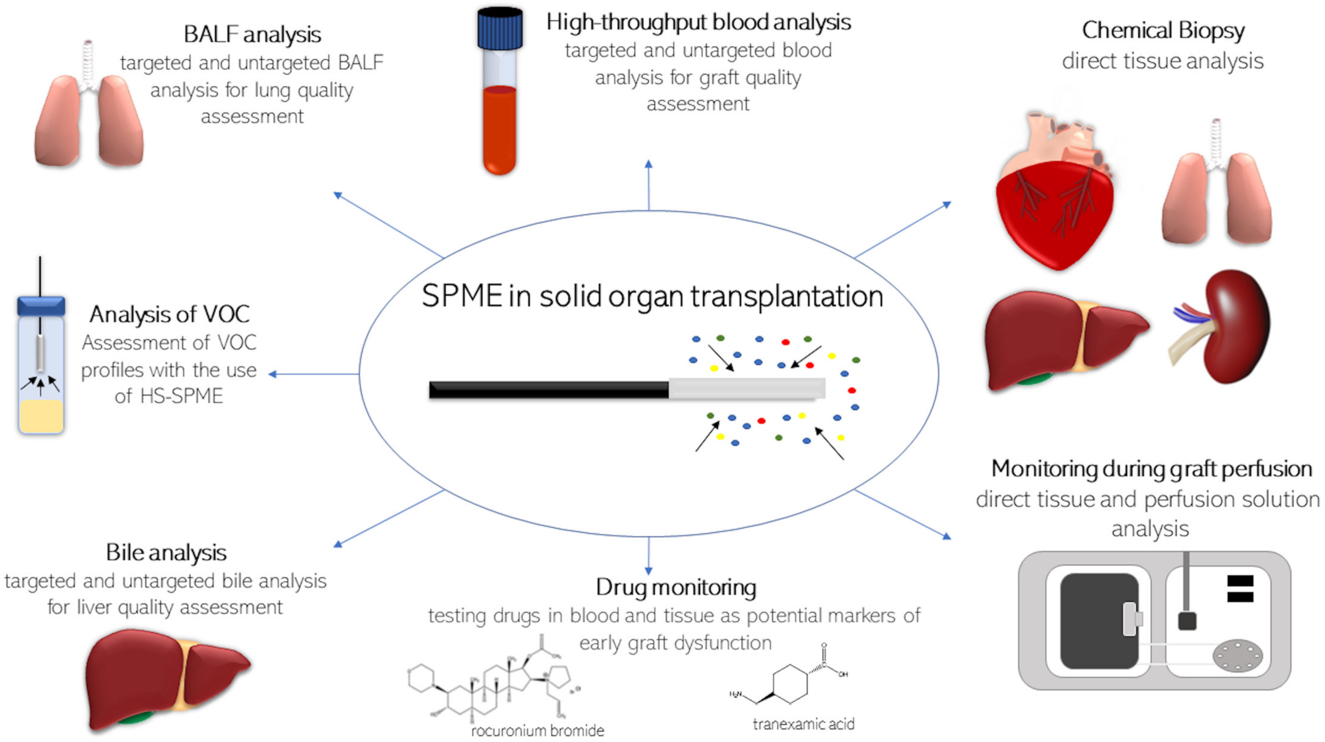 Separations | Free Full-Text | Solid Phase Microextraction—A Promising Tool for Graft Quality ...