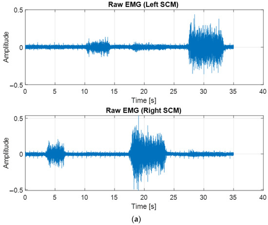 Development of Surface EMG Game Control Interface for Persons with ...