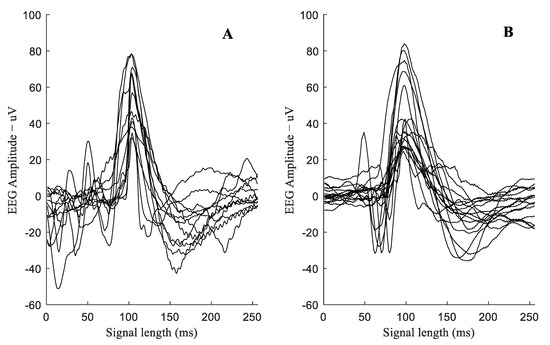Early Signatures of Brain Injury in the Preterm Neonatal EEG