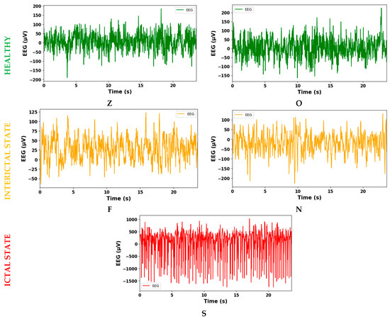 Signals | Free Full-Text | EEG-Based Seizure Detection Using Variable ... Signals | Free Full-Text | EEG-Based Seizure Detection Using Variable ...