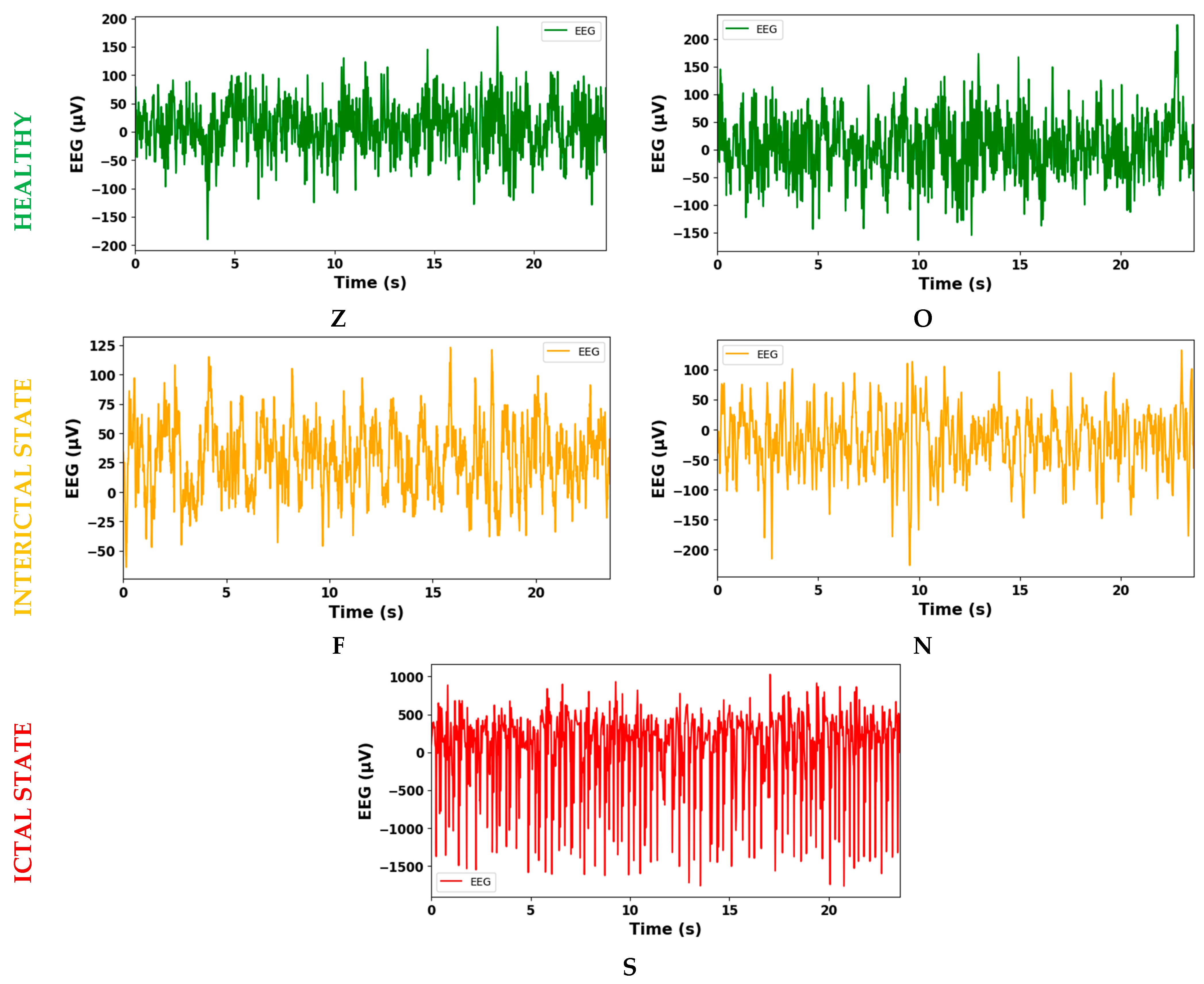 Signals | Free Full-Text | EEG-Based Seizure Detection Using Variable-Frequency Complex ...