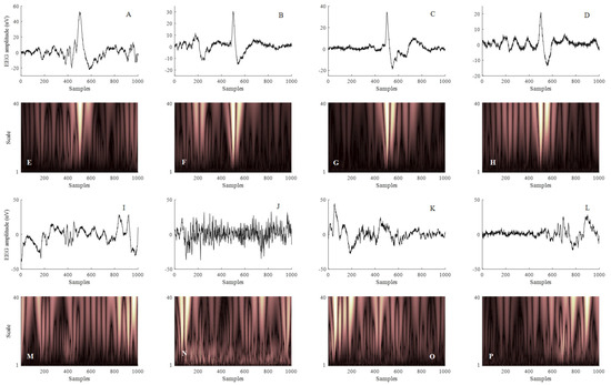 CNN-Based Pattern Classifiers for Precise Identification of Perinatal ...