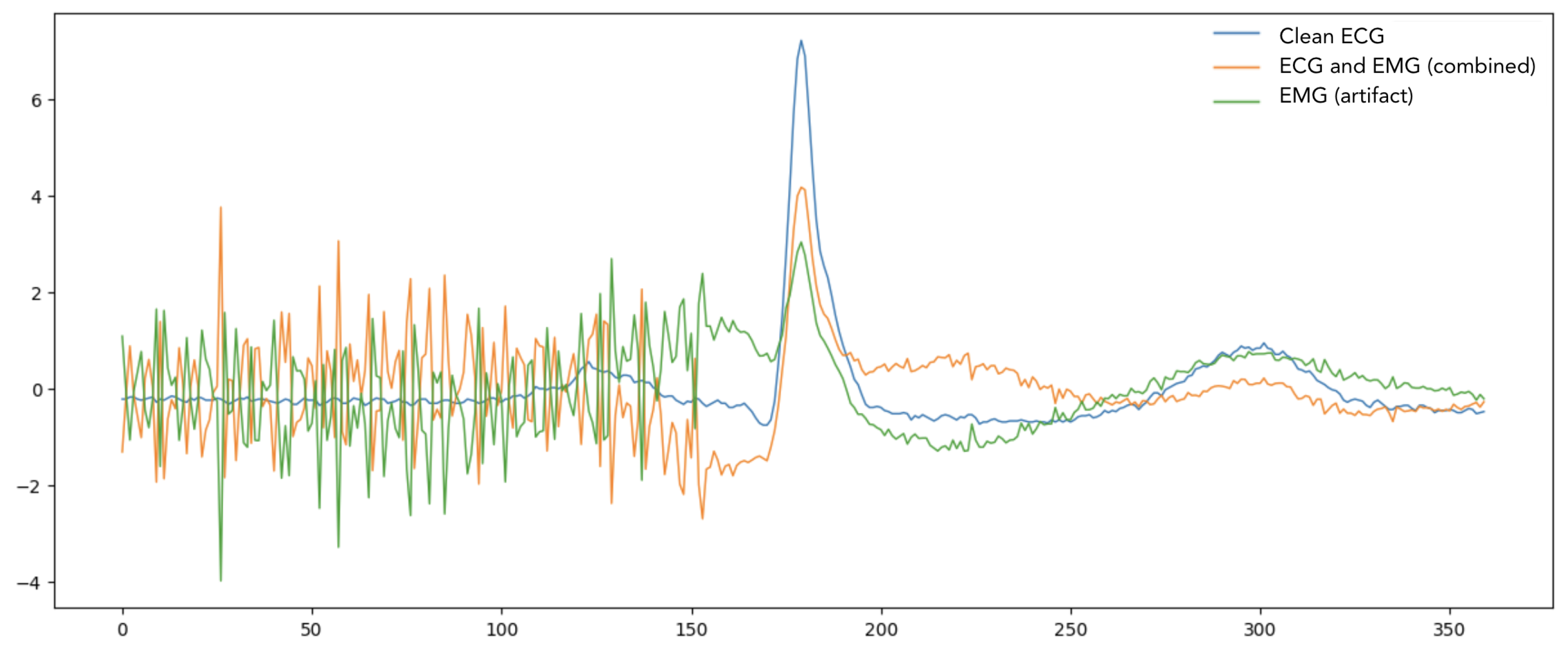 Self Attention-Driven ECG Denoising: A Transformer-Based Approach for ...