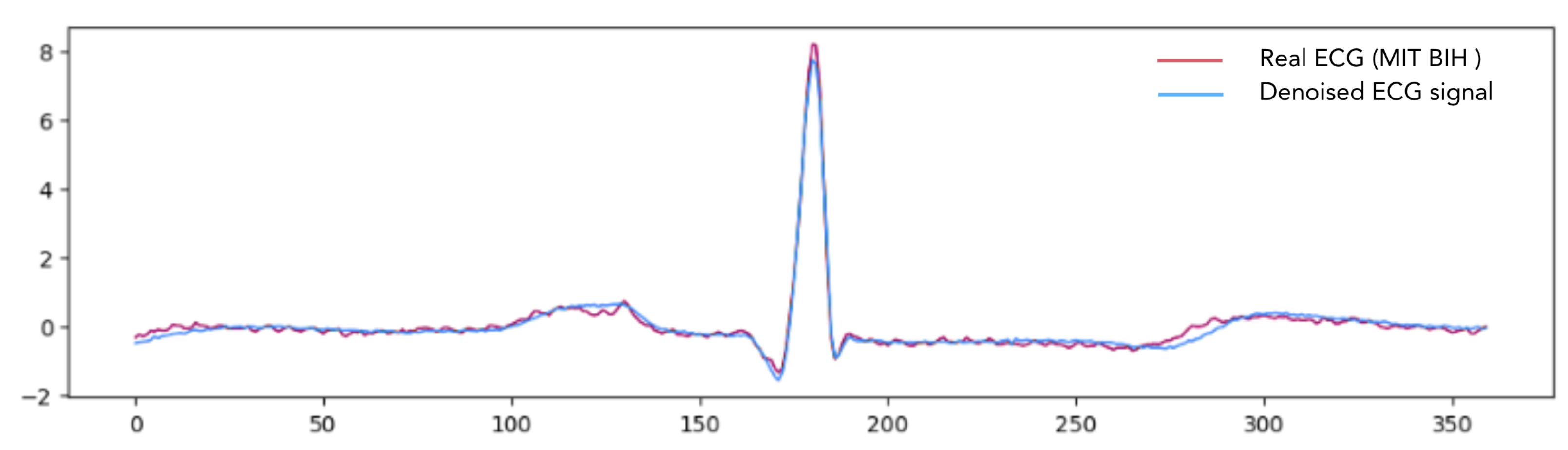Self Attention-Driven ECG Denoising: A Transformer-Based Approach for Robust Cardiac Signal ...